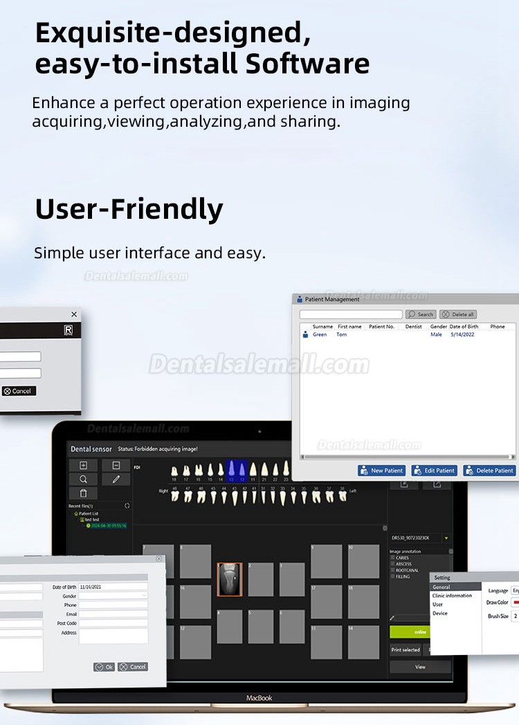 Dental Digital X-Ray Sensor RVG Intraoral Sensor System HD Image With ...
