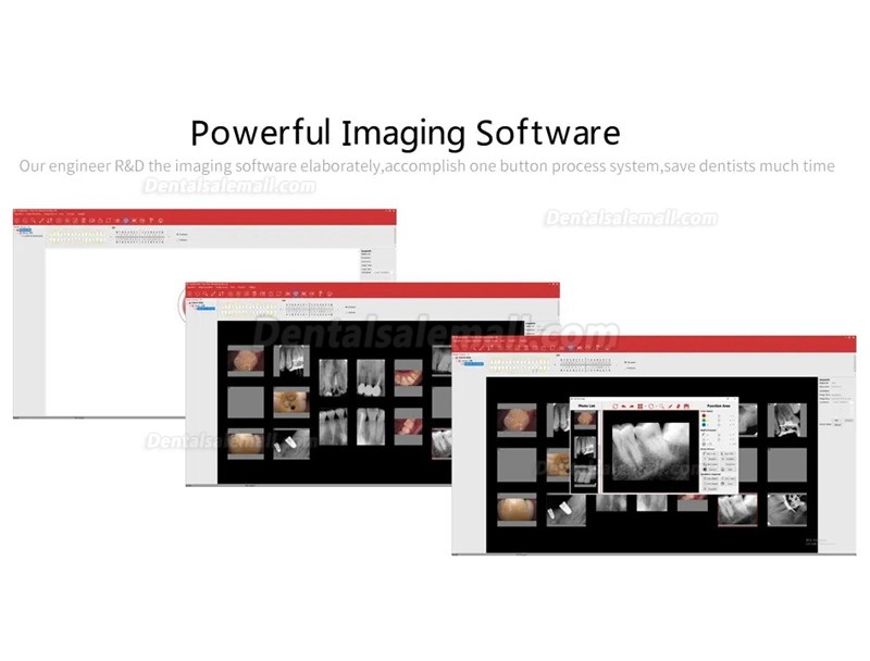 Handy High Resolution Digital USB Type Dental X Ray Sensor Rvg HDR-500B ...