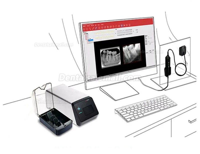Handy HDS-500 PSP Scanner Digital Dental Imaging Phosphor Plate Scanner ...