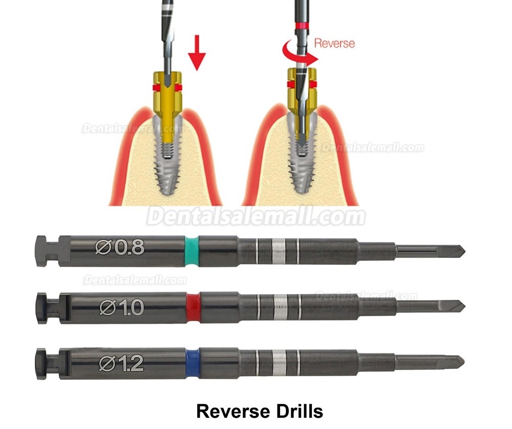 Universal Implant Fractured Screw Removal Kit Implant Broken Screw ...