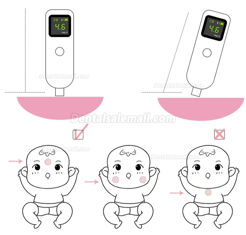 Luckcome L11C Neonatal Jaundice Meter Bilirubin Meter Jaundice Detector ...