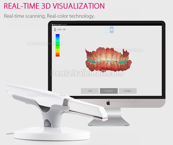 Runyes 3DS Dental 3D Digital Intraoral Scanner Powderless Real Color ...