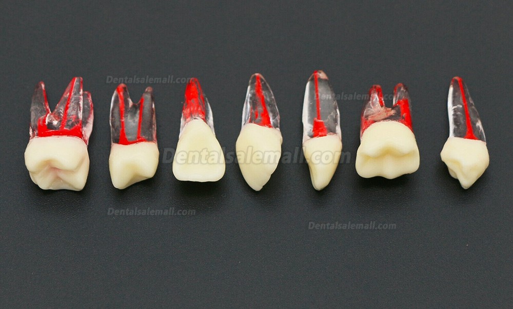 7Pcs Dental Endodontic Root Canal RCT Practice Endo Teeth Model Pulp ...